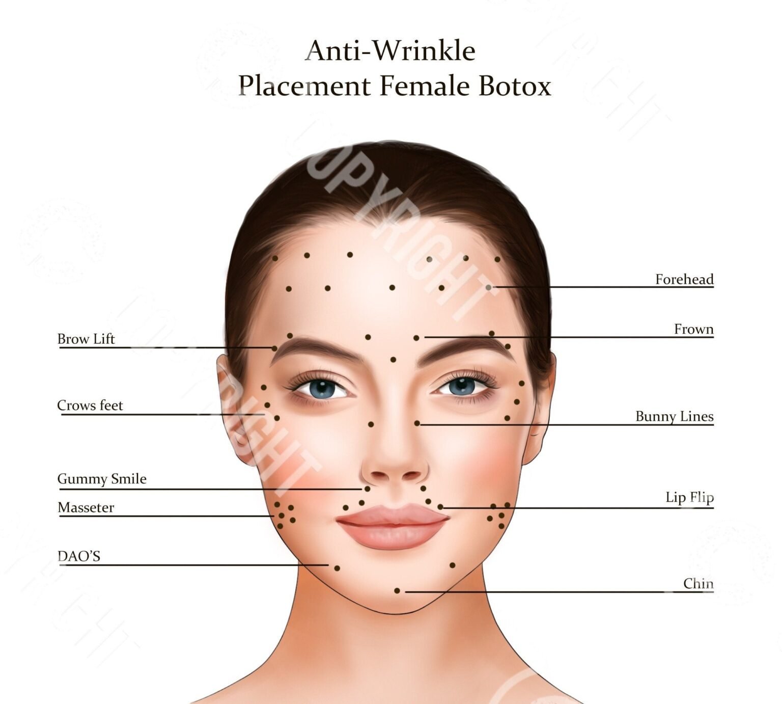 Giorgia Anti-wrinkle Injection Points Poster Digital Download - Nita ...